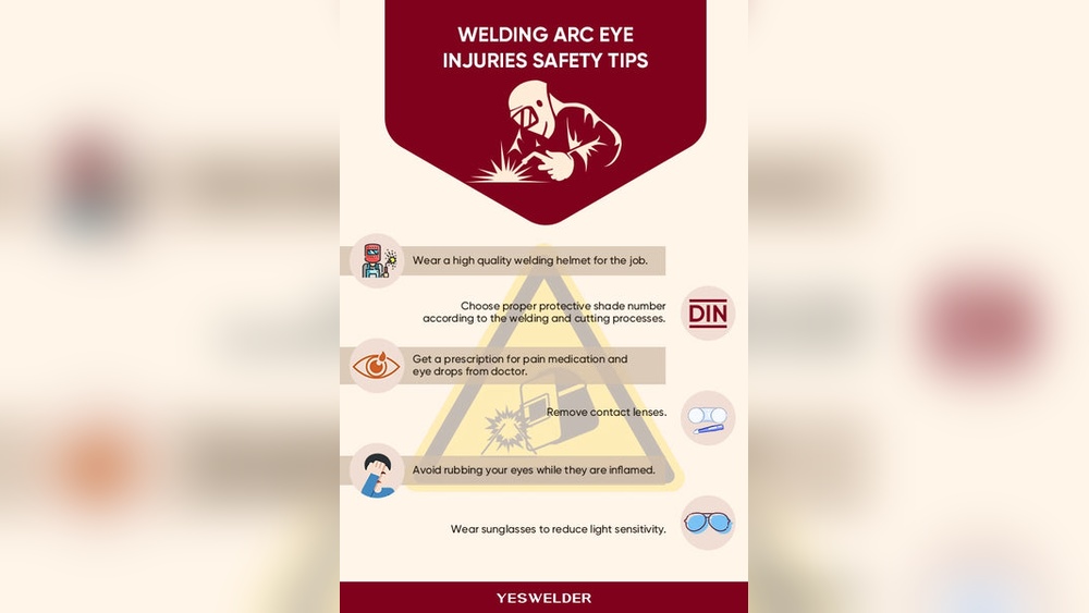 How to Prevent Arc Eye While Welding: Essential Safety Tips